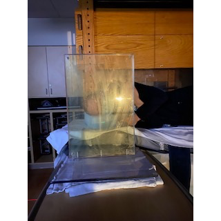 Total Body Irradiation (TBI) | OncoLink