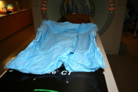 Radiation Therapy Immobilization Devices | OncoLink